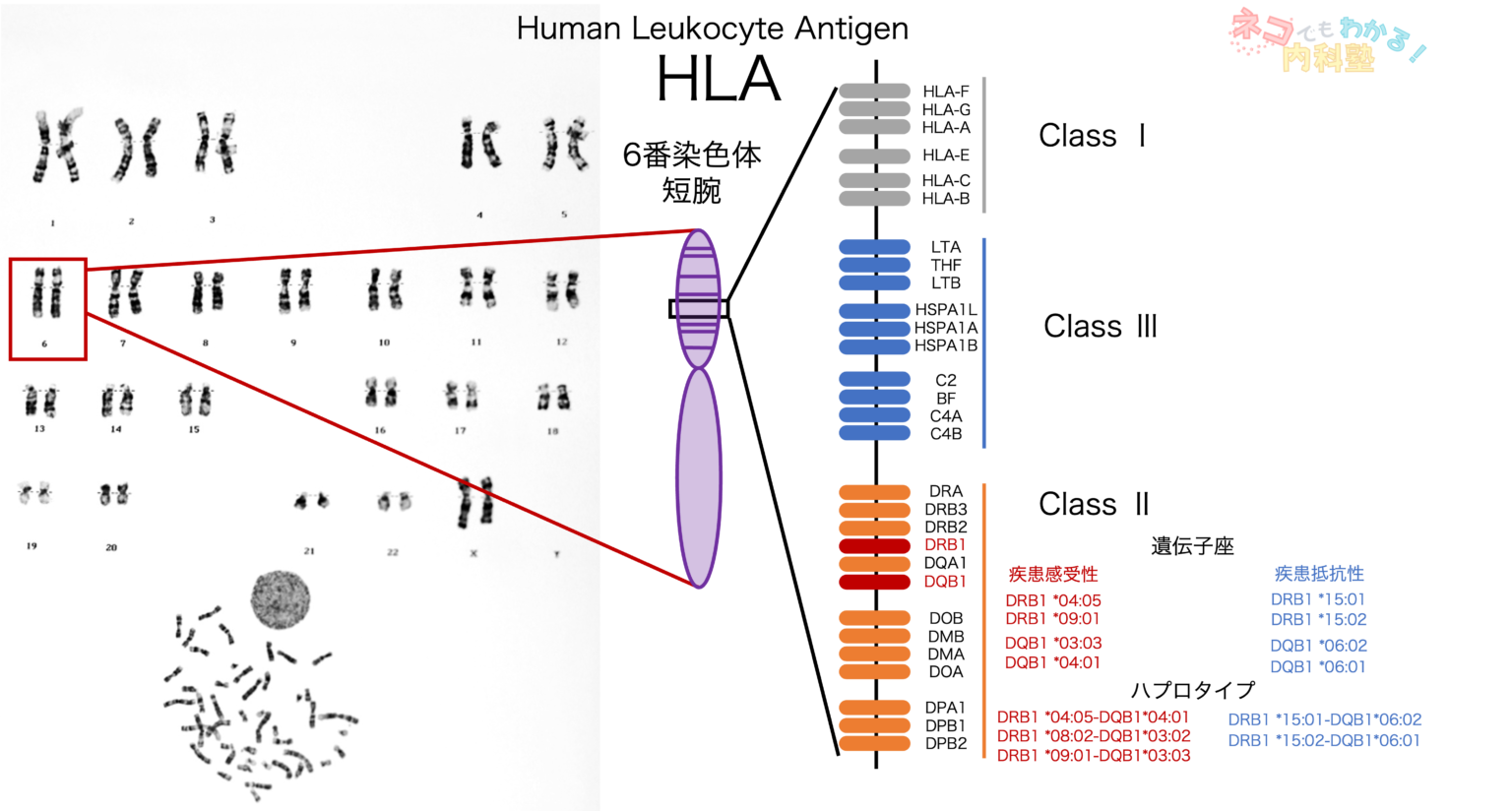 1型糖尿病とは〈発症契機，分類，病態，抗GAD抗体〉｜ネコでもわかる内科塾